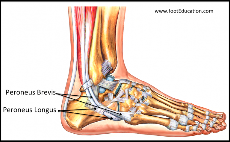 Peroneal Tendonitis - Eddie O'Grady Physiotherapist